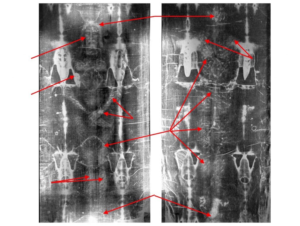 Wounds Depicted - Shroud of Turin Information